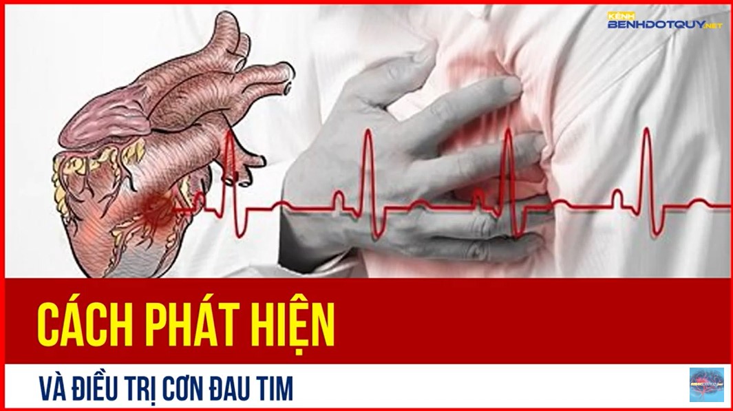 Cách phát hiện và điều trị cơn đau tim | Bệnh đột quỵ