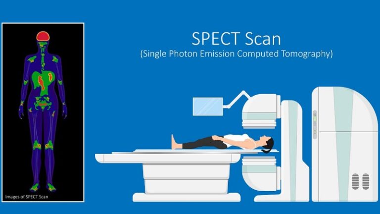 Chụp cắt lớp vi tính phát xạ đơn photon (SPECT) cần lưu ý gì?