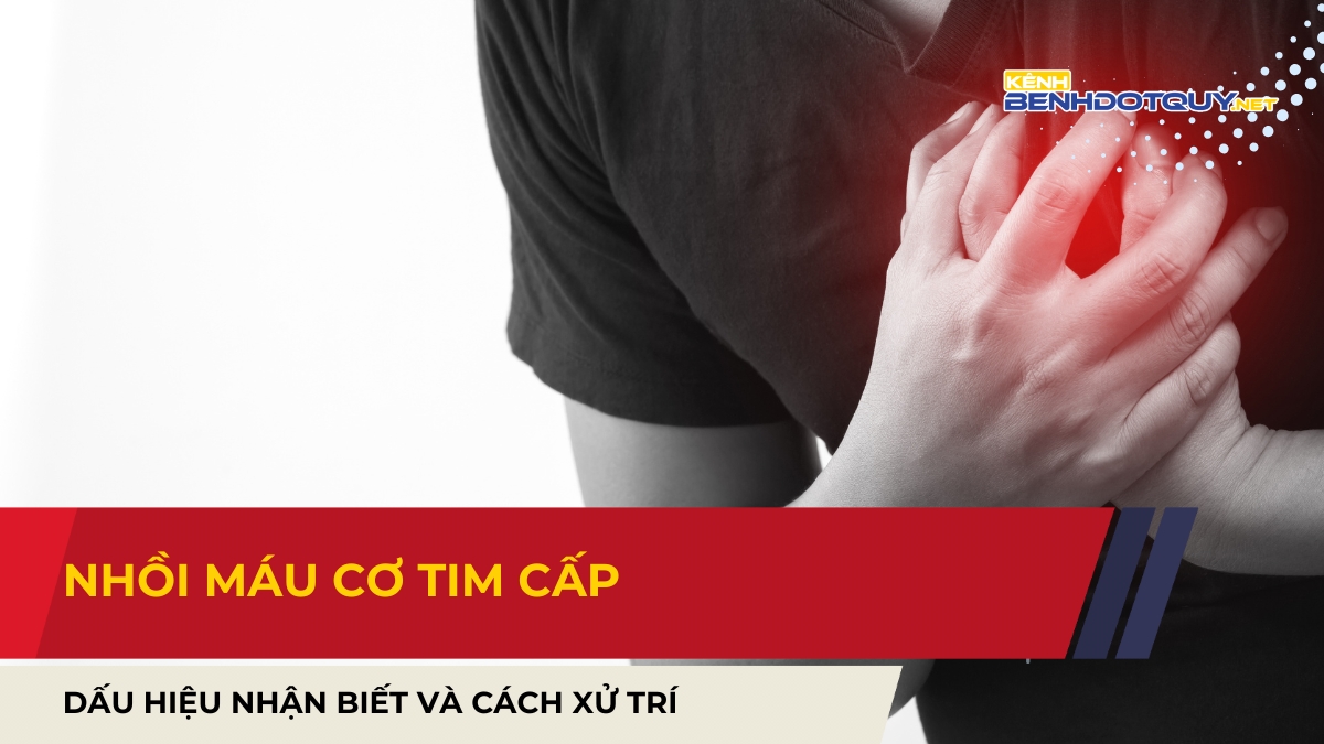 Nhồi máu cơ tim cấp: Dấu hiệu nhận biết và cách xử trí để cứu sống ...